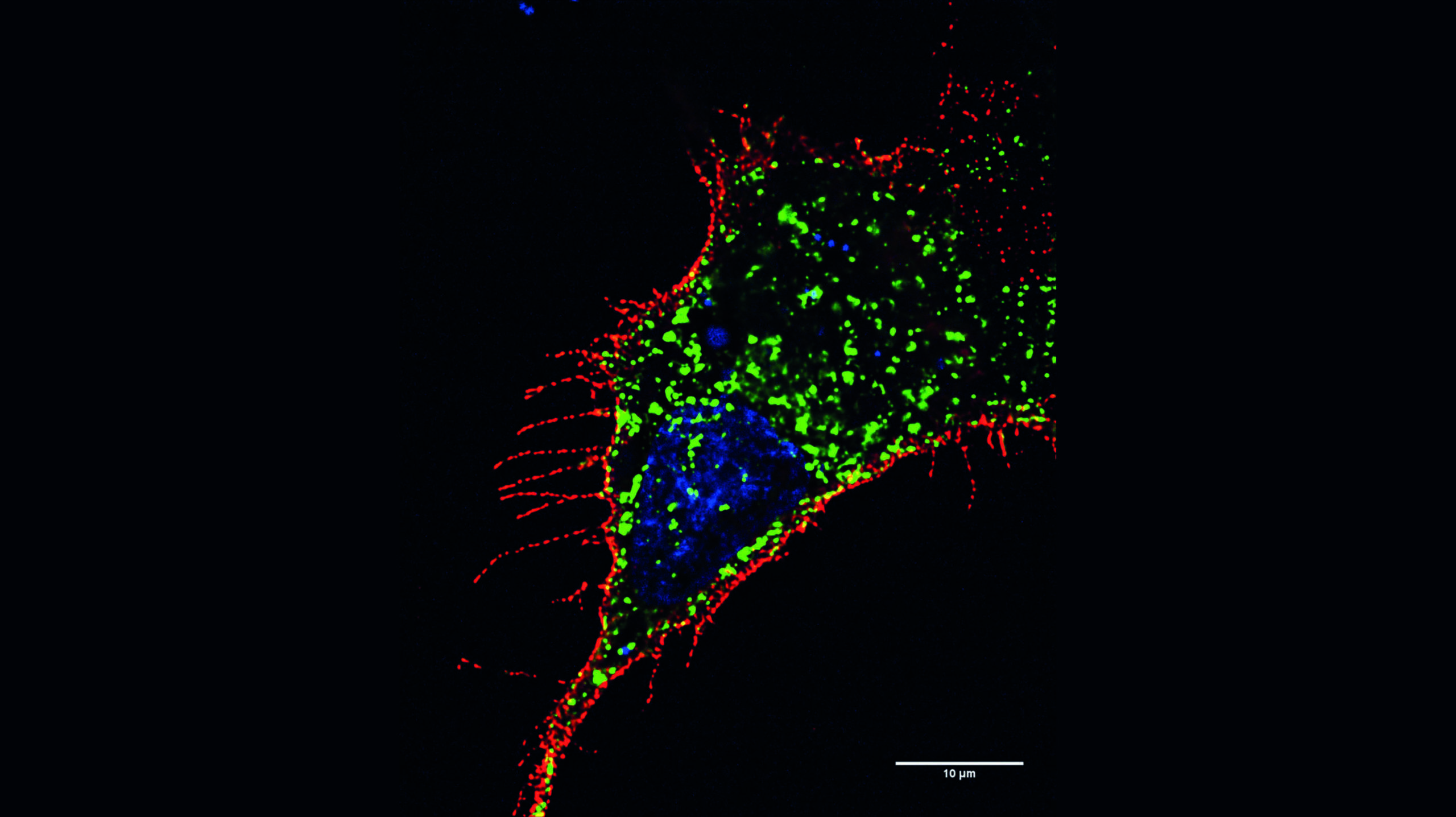 Borghi Lab - Tension makes the cell throw up - Institut Jacques Monod